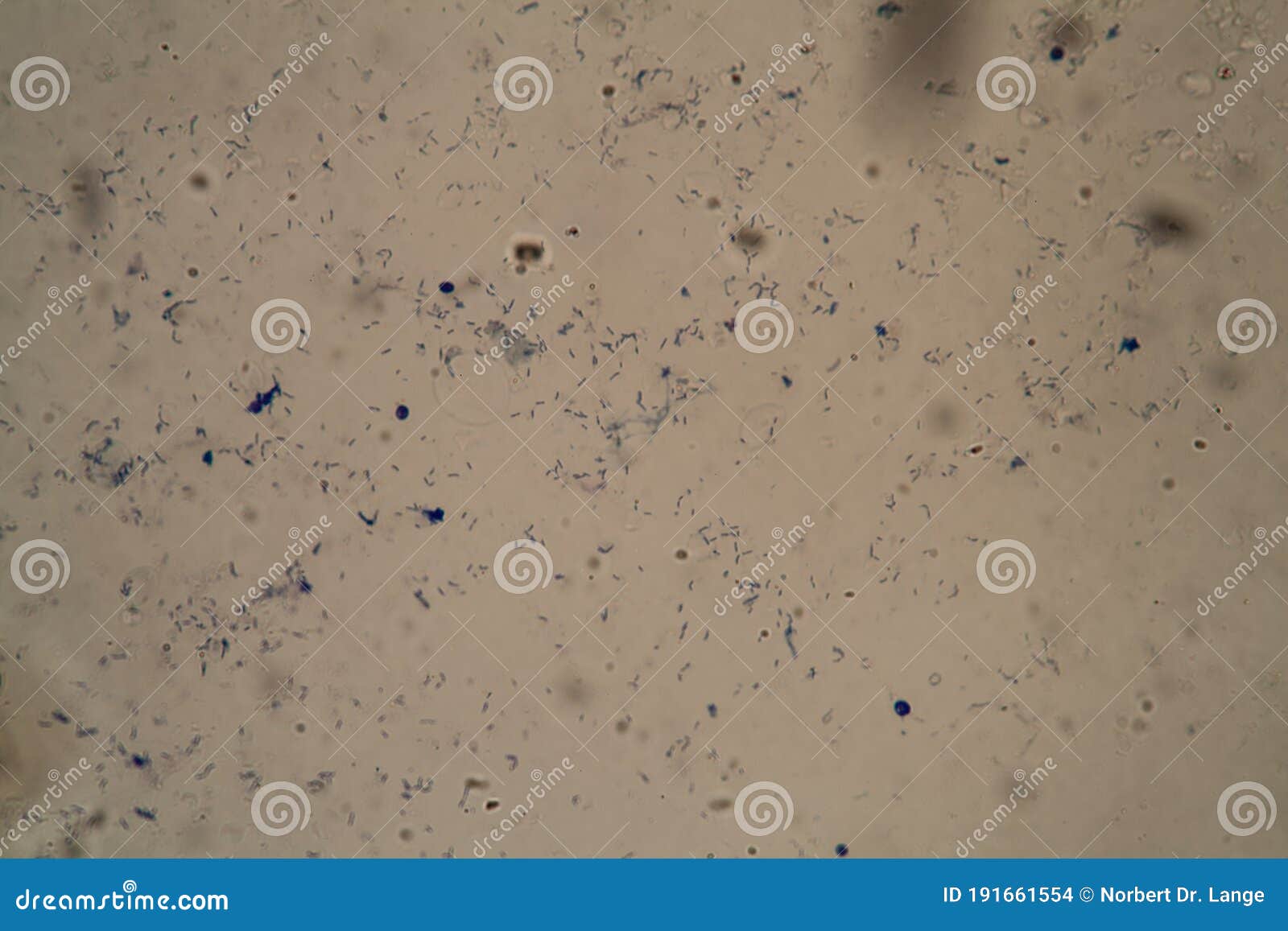 Coccus Bacteria 400x