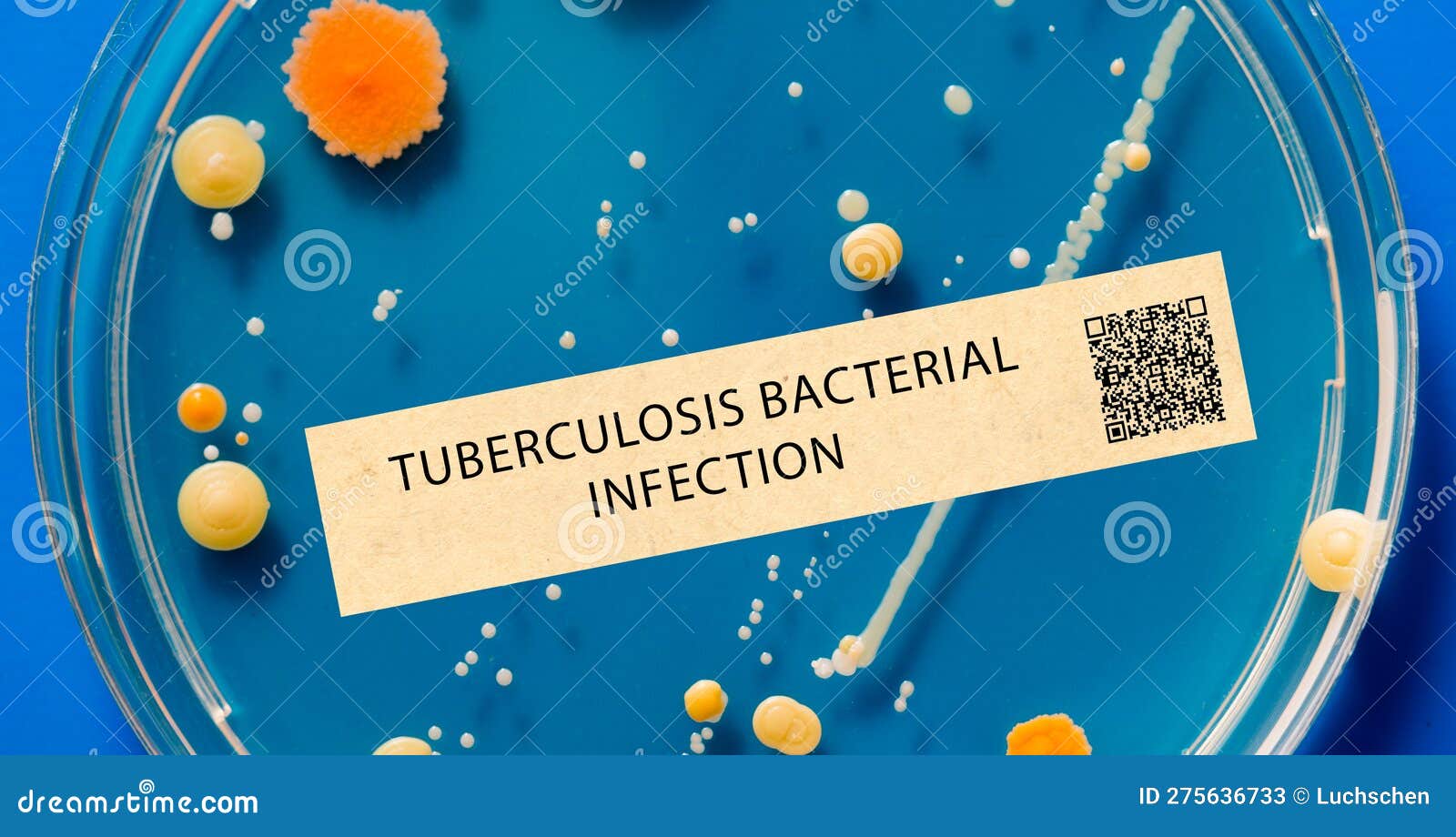 Tuberculosis - Bacterial Infection that Usually Affects the Lungs and is Spread through the Air ...