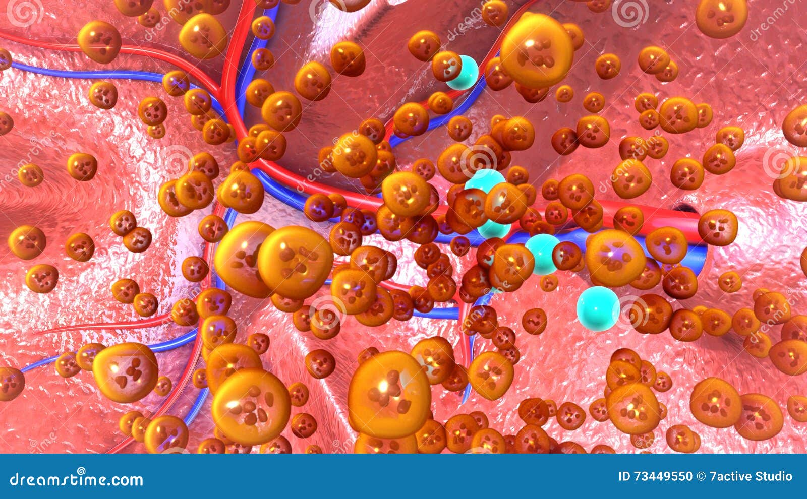 Tuberculosis Virus stock illustration. Illustration of bacterial - 73449550