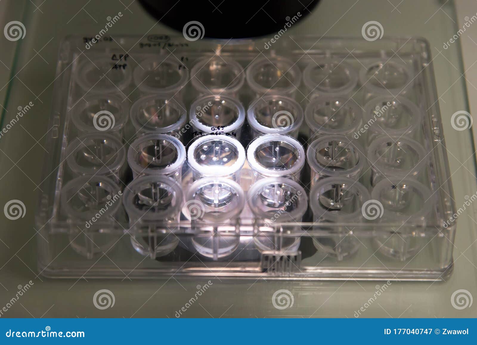 Tubes in a Biochemistry Labor Stock Image - Image of injection, virus ...