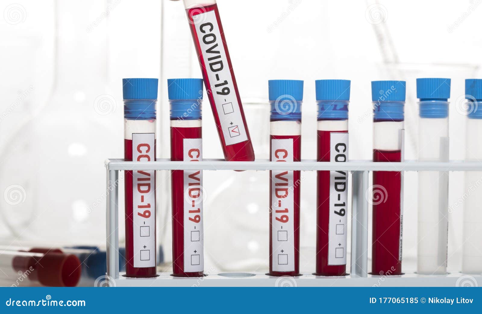 Tubes of Biological Sample Contaminated by Coronavirus with Label Covid ...