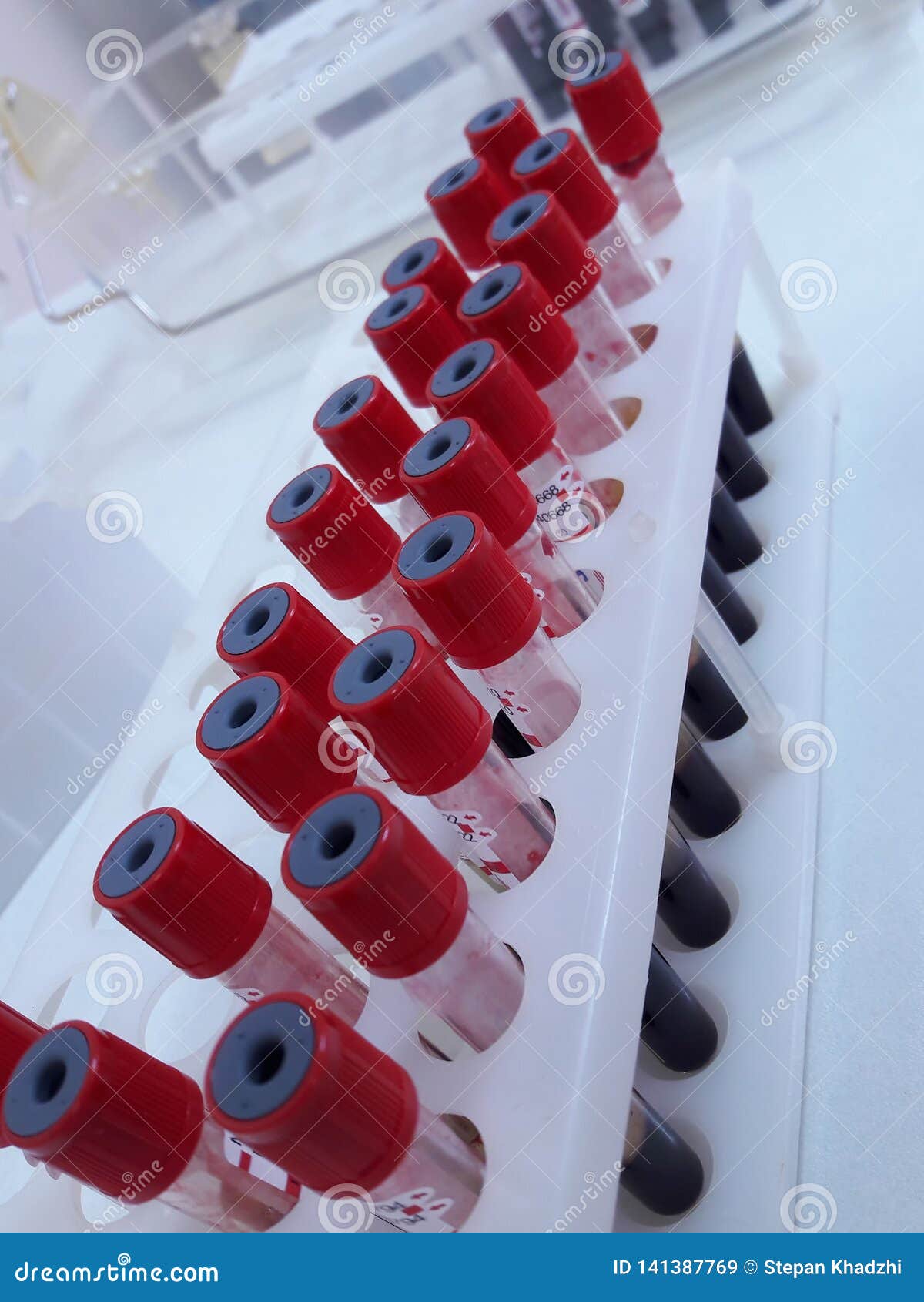 Tubes of Blood Sample for Lab Testing Stock Image - Image of medicine ...