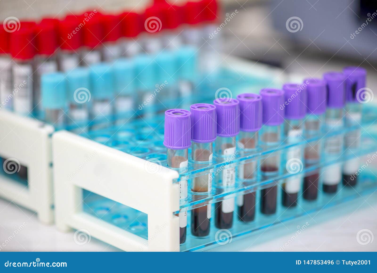 Tubes of Blood Sample for Testing Stock Photo - Image of healthcare ...