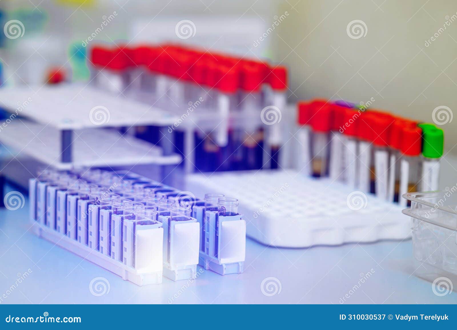 Tubes of Blood Sample for Testing in Laboratory. Rack of Flasks in ...