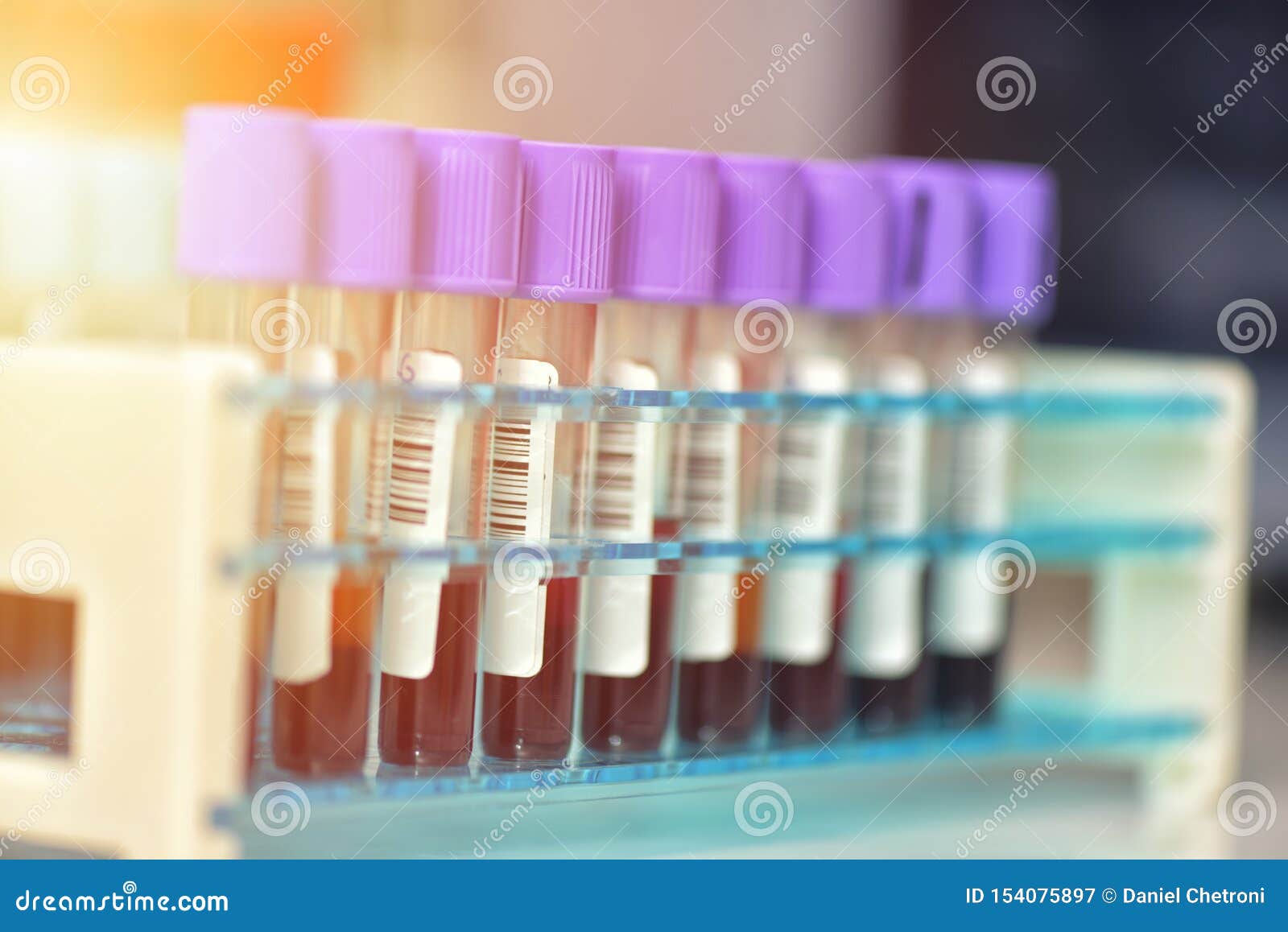 Tubes of Blood Sample for Testing. Medical Equipment Stock Image ...