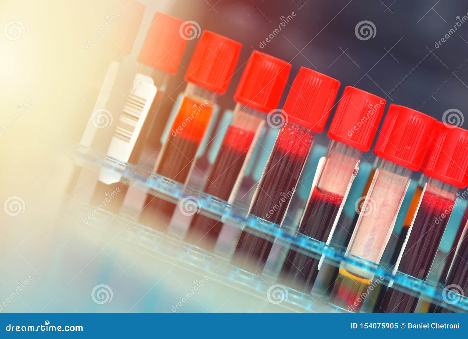 Tubes of Blood Sample for Testing. Medical Equipment Stock Image ...