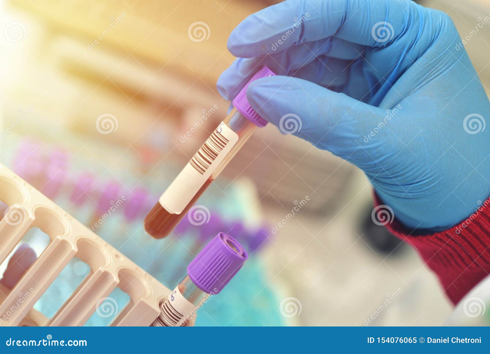 Tubes of Blood Sample for Testing. Medical Equipment Stock Image ...