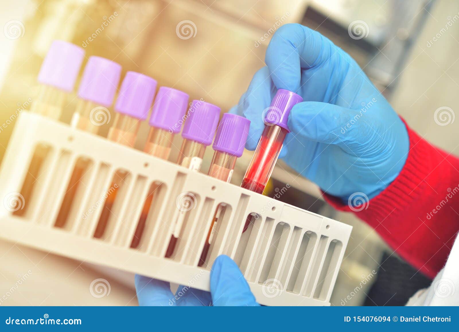 Tubes of Blood Sample for Testing. Medical Equipment Stock Photo ...
