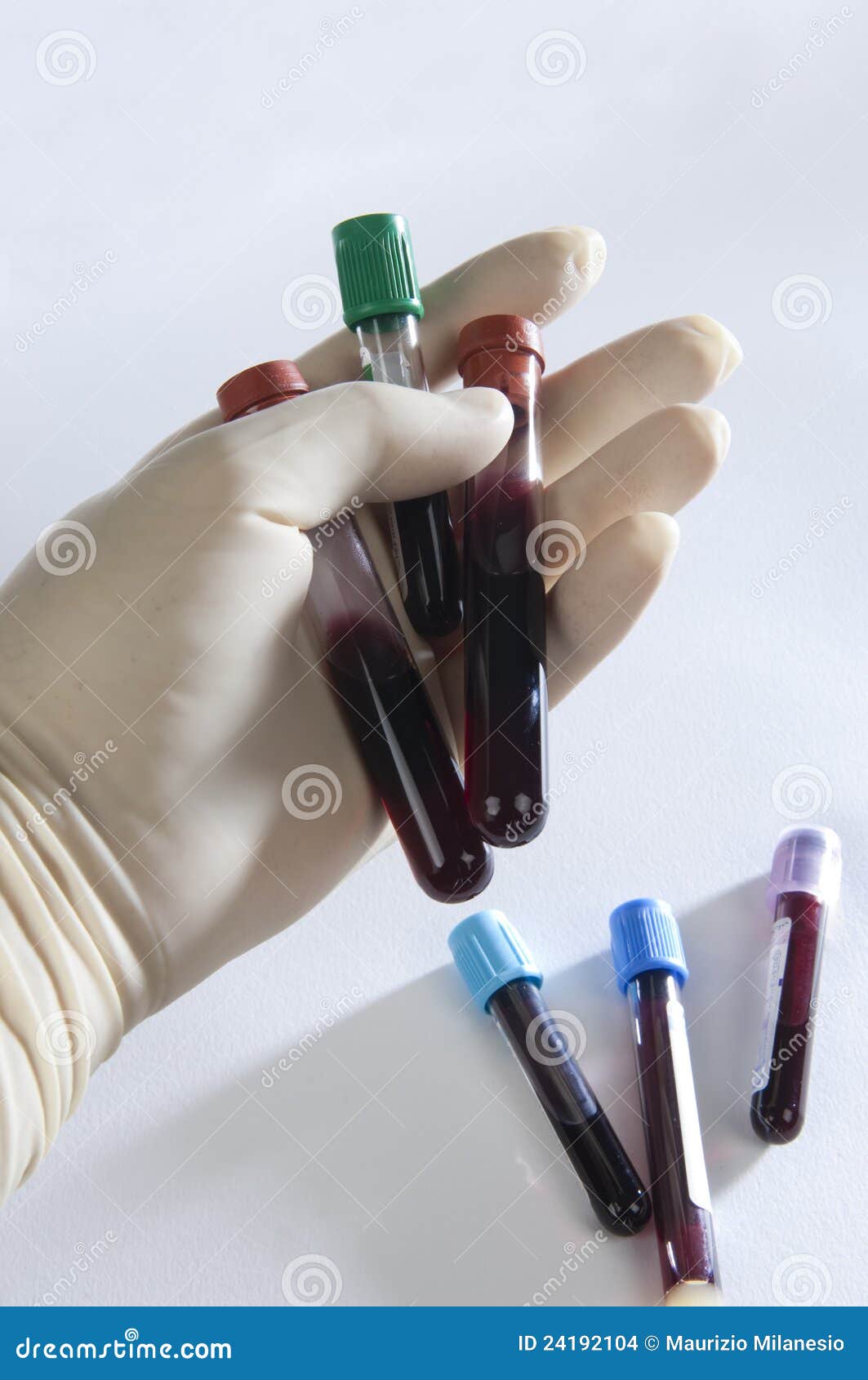Tubes, and blood samples stock photo. Image of clot, biohazard - 24192104