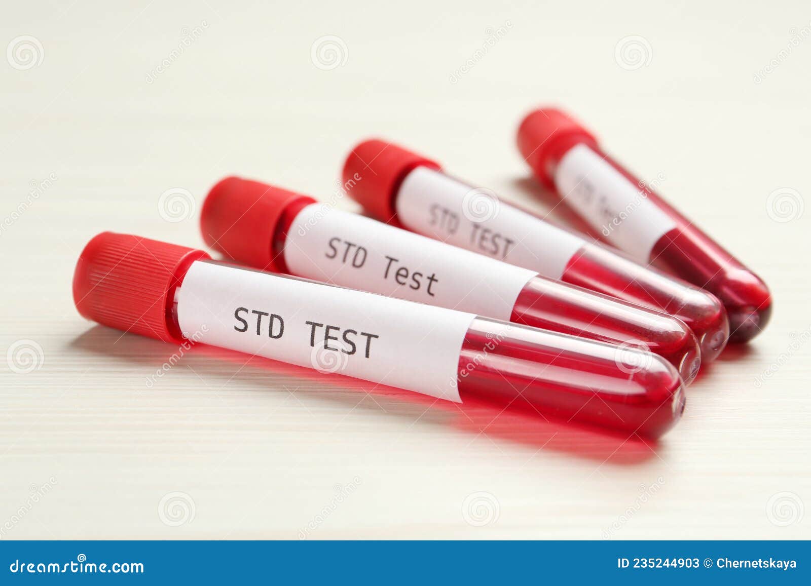 Tubes with Blood Samples and Labels STD Test on White Wooden Table ...
