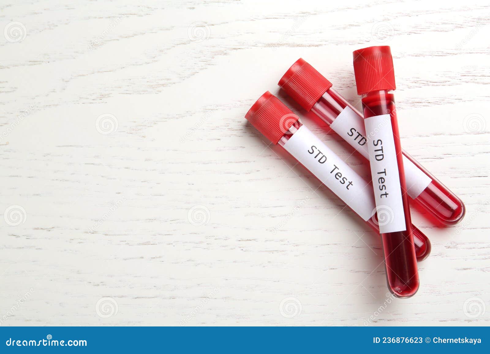 Tubes with Blood Samples and Labels STD Test on White Wooden Table ...