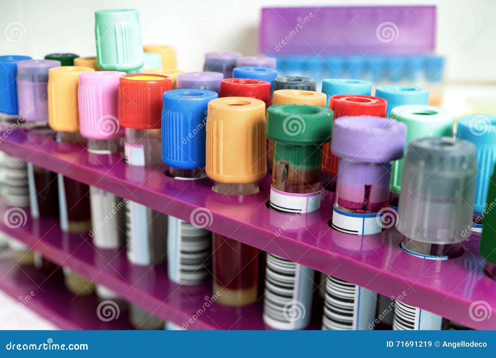 Tubes with blood on a tray stock image. Image of healthcare - 71691219