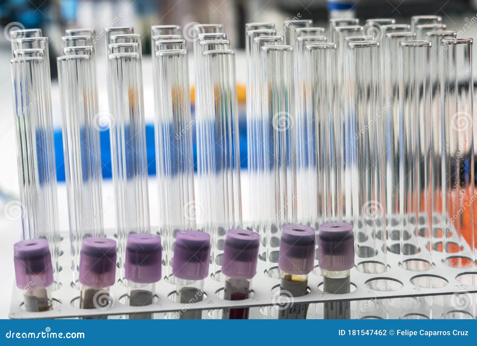 Tubes D'essai En Laboratoire Photo stock - Image du médecine ...