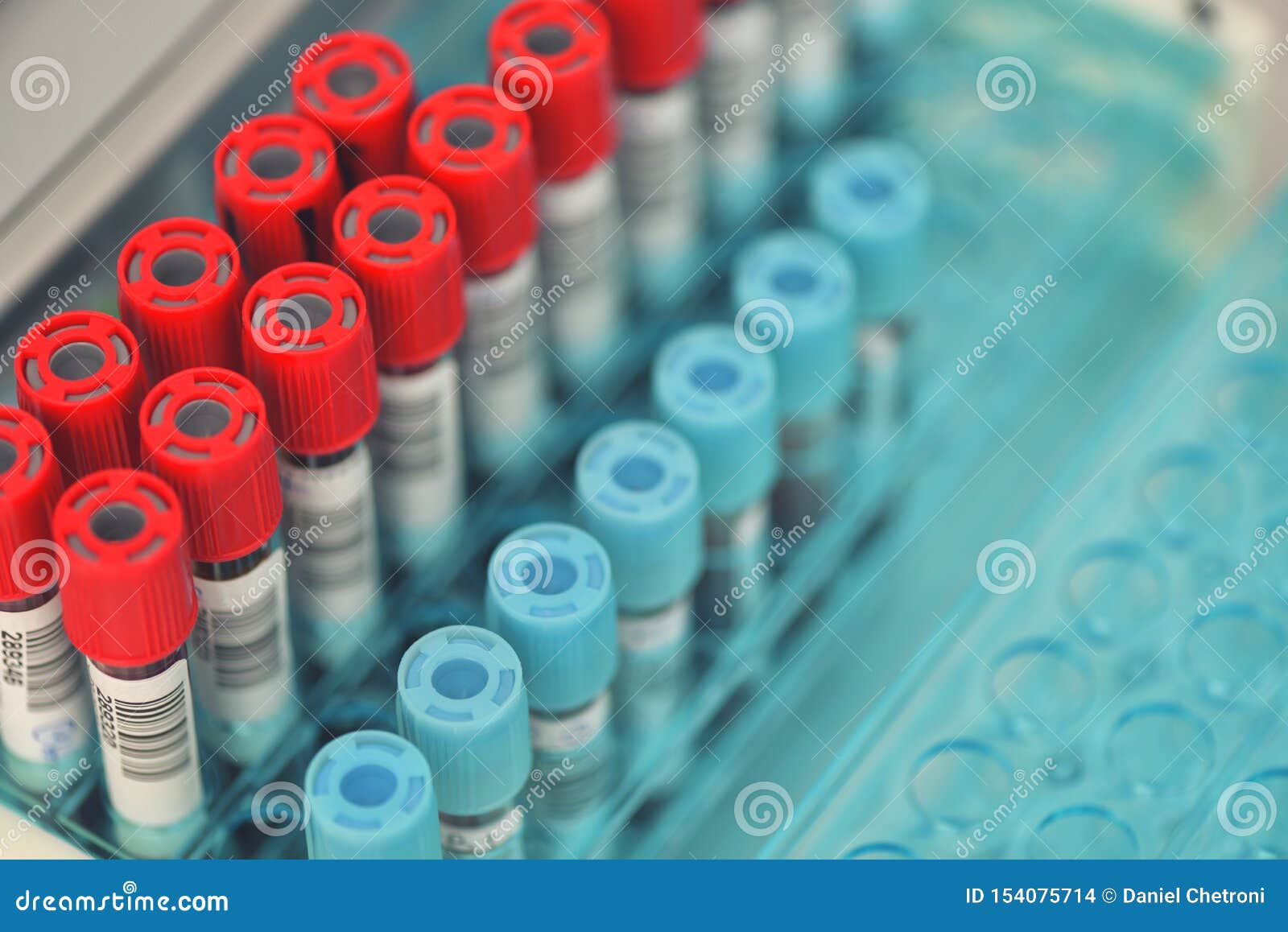 Tubes De Prise De Sang Pour L'essai Mat?riel M?dical Photo stock - Image du homme ...