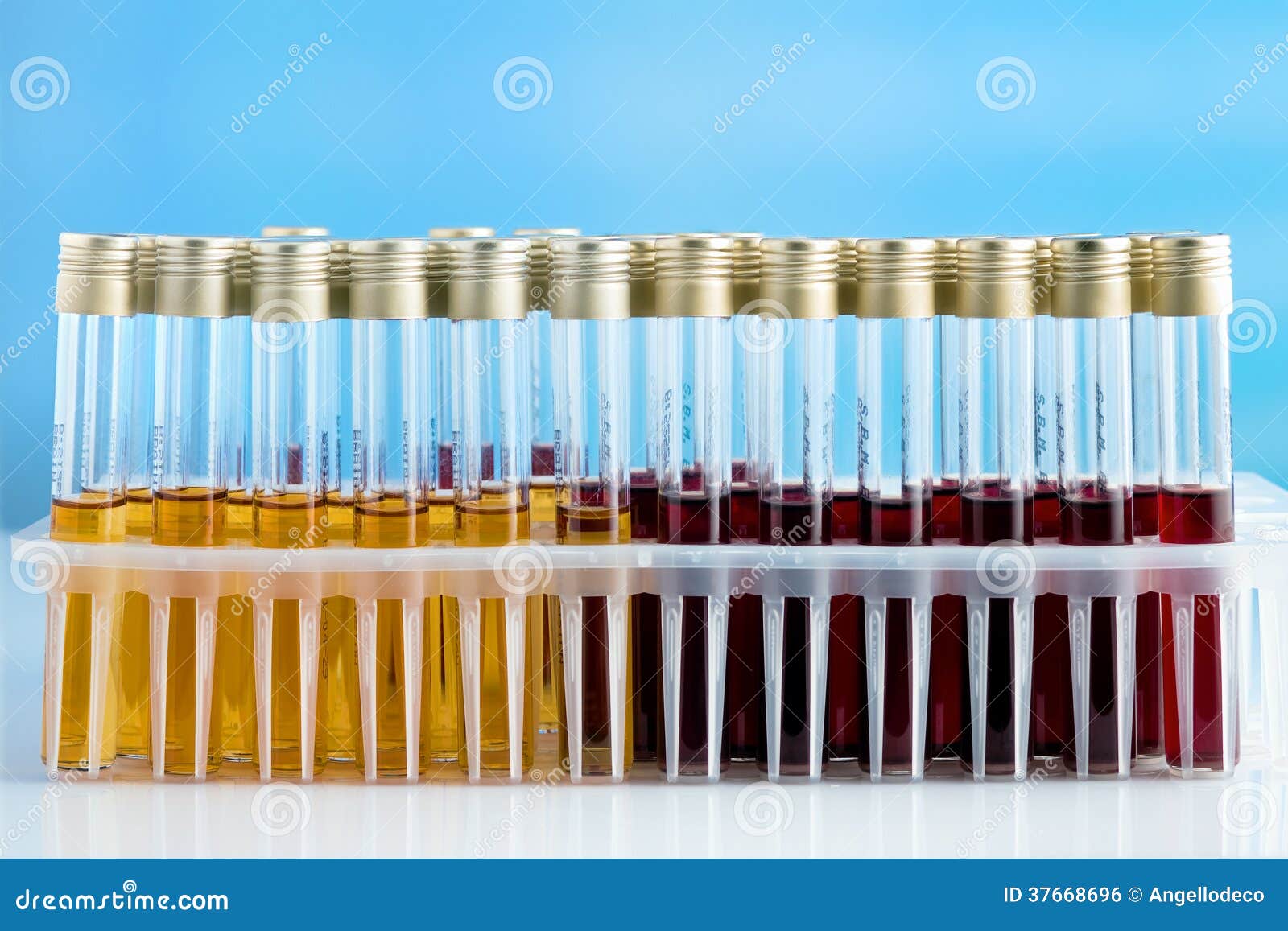 Tubes with liquid medium stock photo. Image of laboratory - 37668696