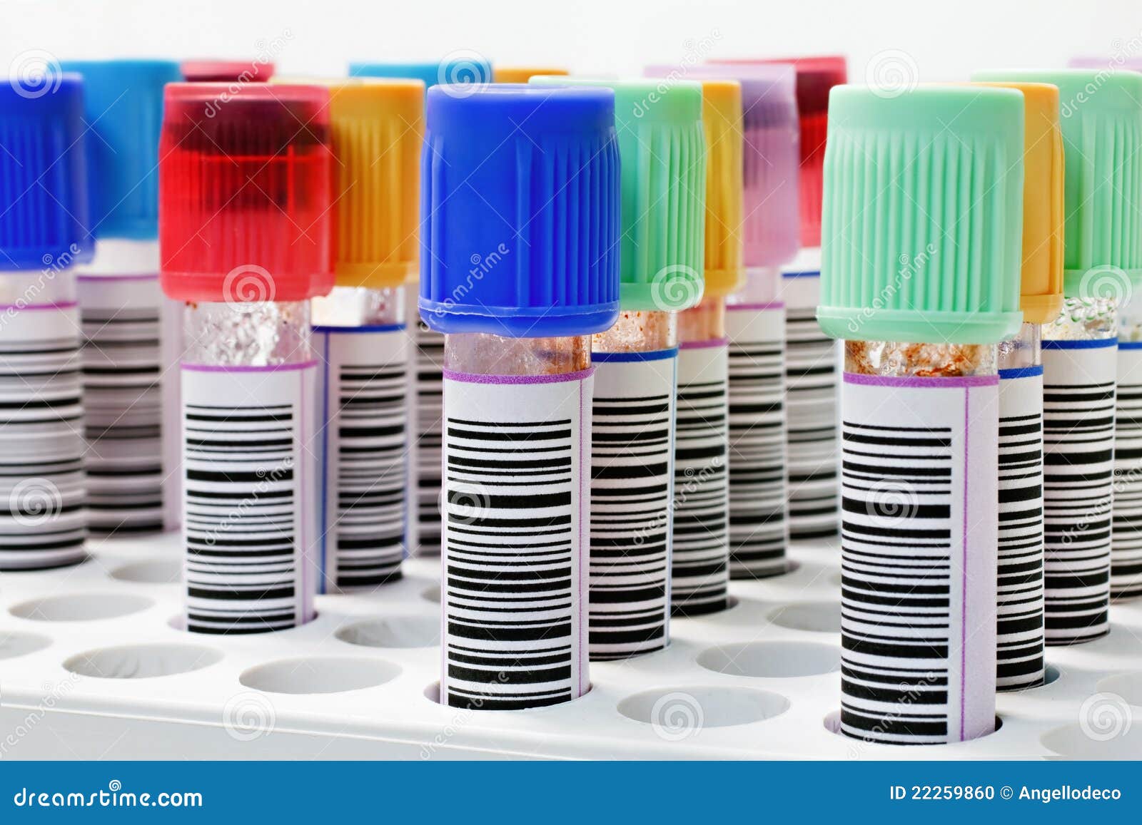 Tubes in a rack stock photo. Image of experiment, examination - 22259860