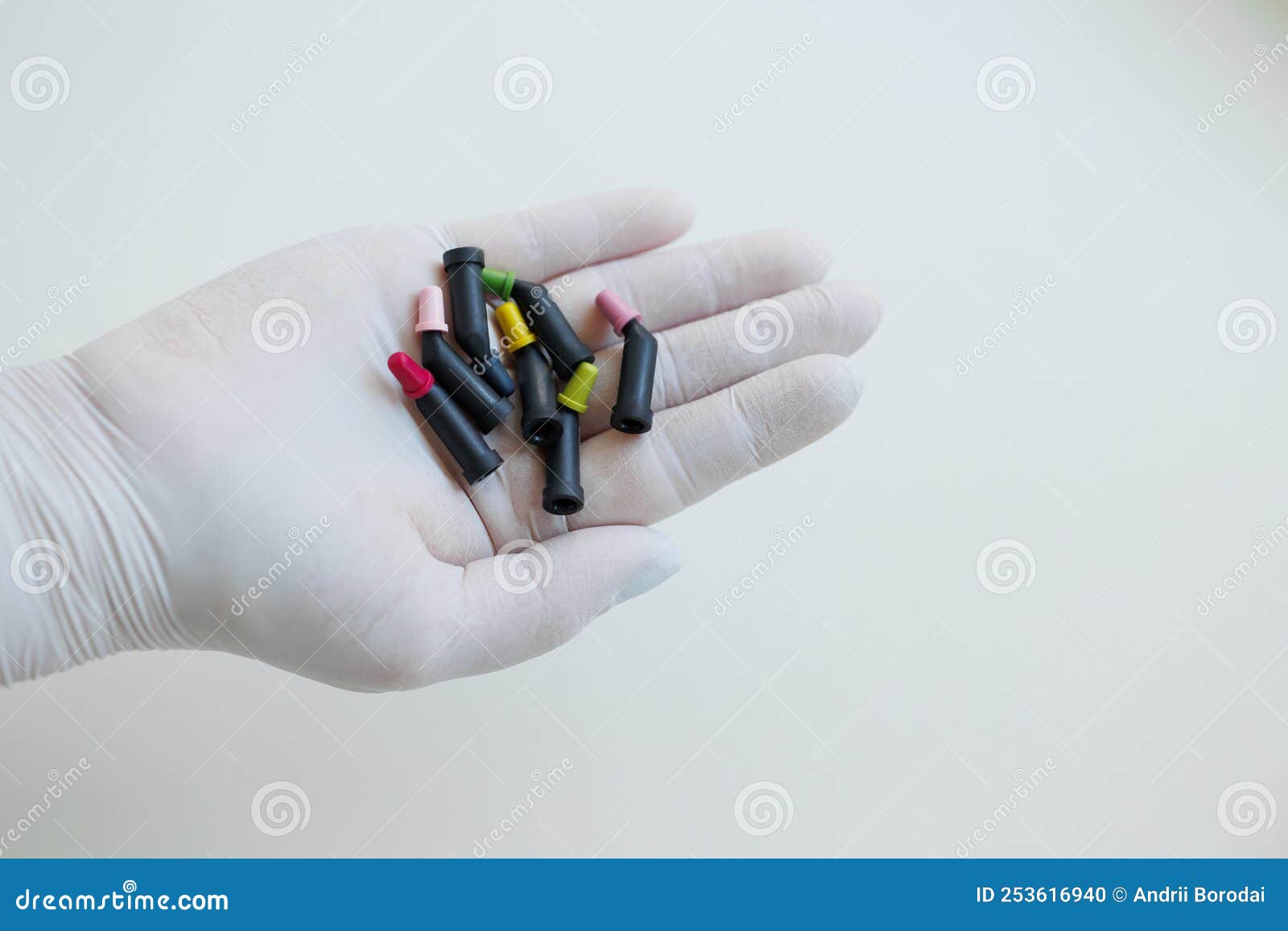 Tubes with Teeth Composite Filling Materials in Dentist Hands. Stock ...