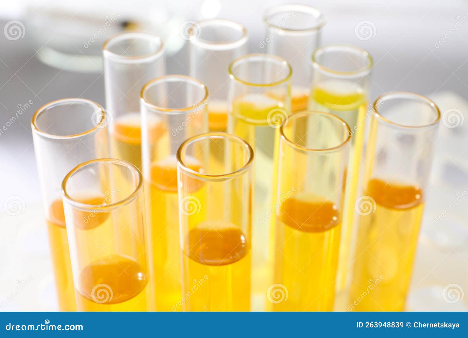 Tubes with Urine Samples for Analysis on Blurred Background, Closeup ...