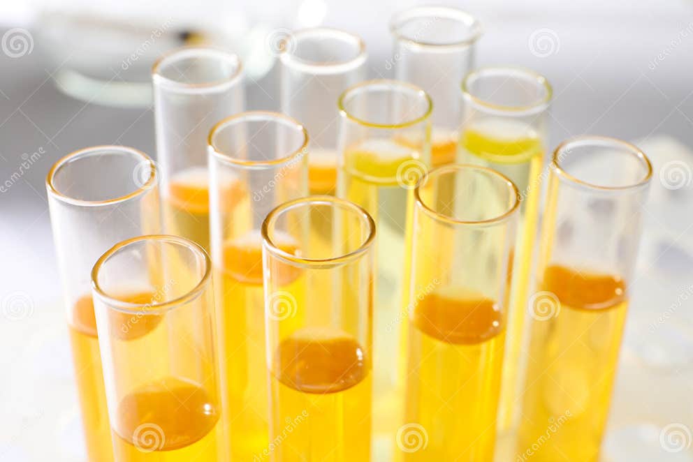 Tubes with Urine Samples for Analysis on Blurred Background, Closeup ...