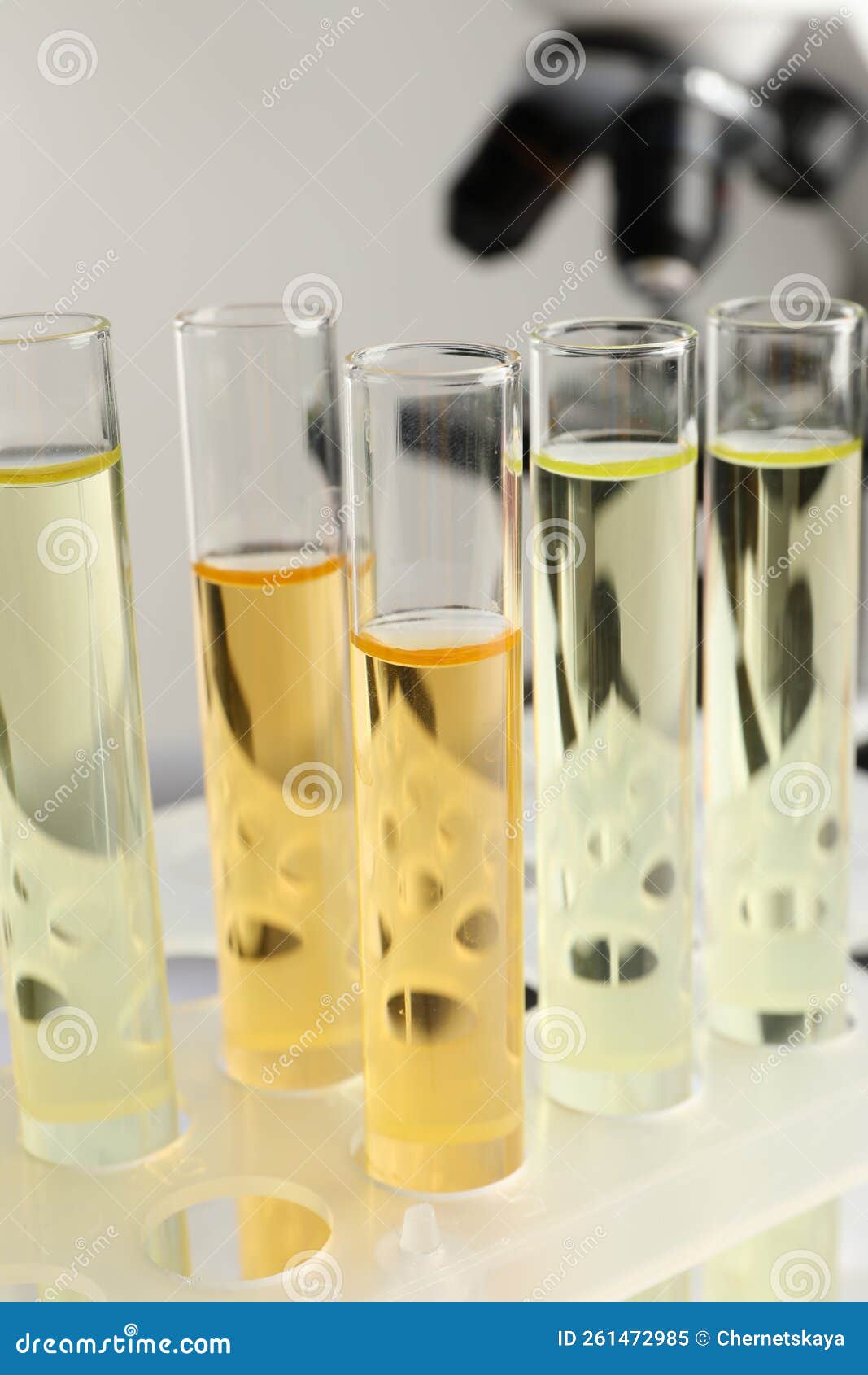 Tubes with Urine Samples for Analysis in Laboratory, Closeup Stock ...