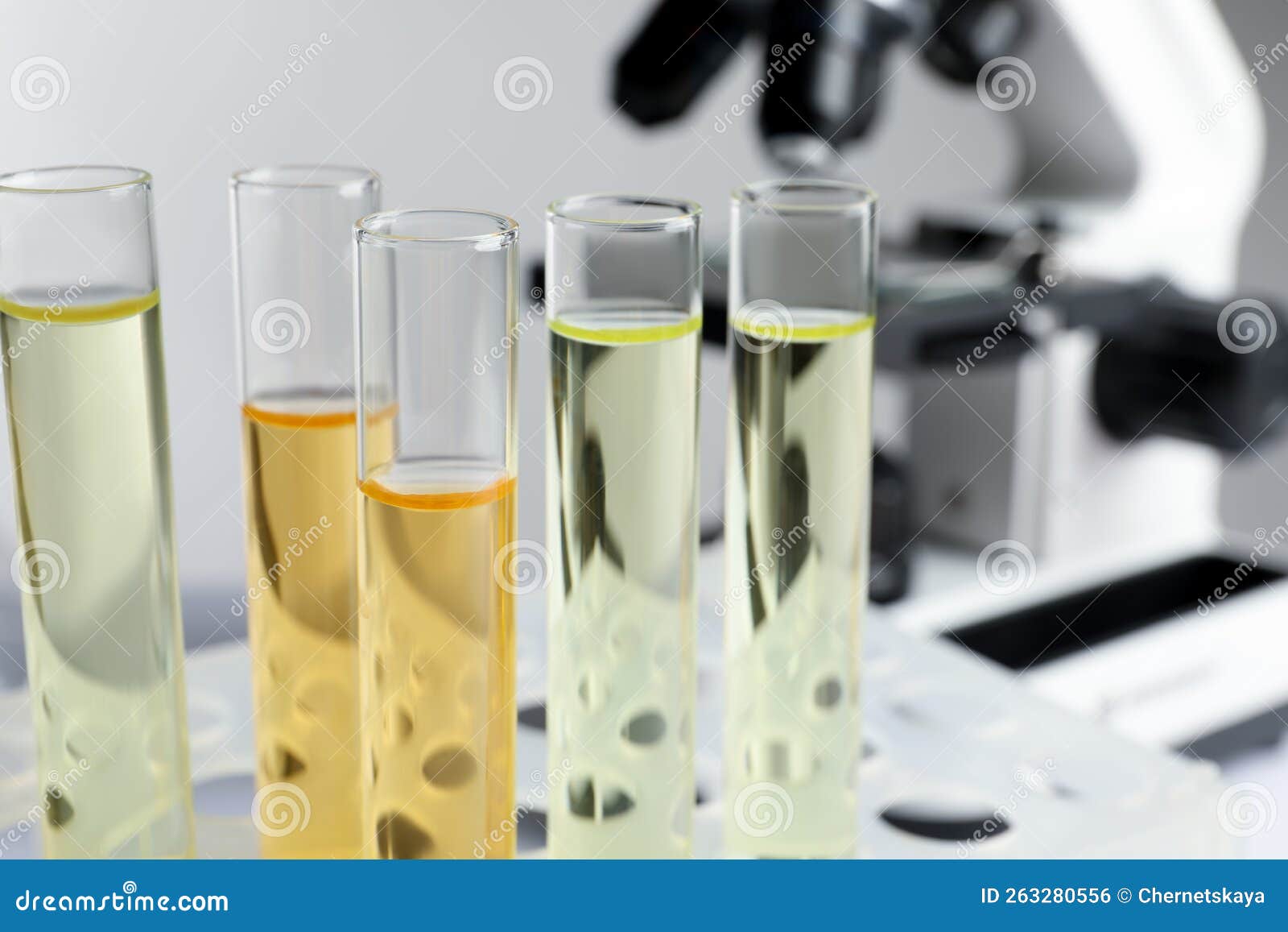 Tubes with Urine Samples for Analysis in Laboratory, Closeup Stock ...