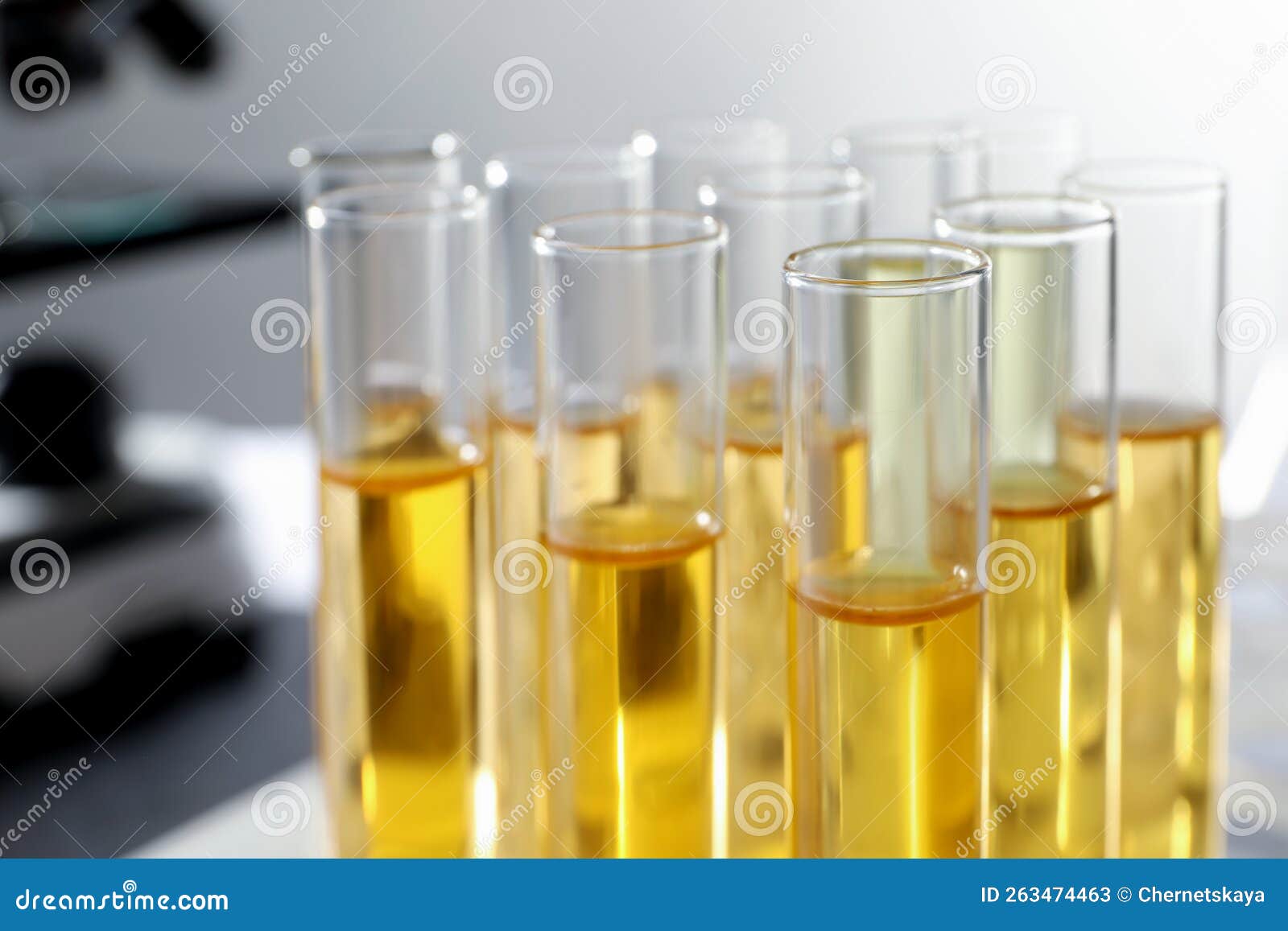 Tubes with Urine Samples for Analysis in Laboratory, Closeup Stock ...