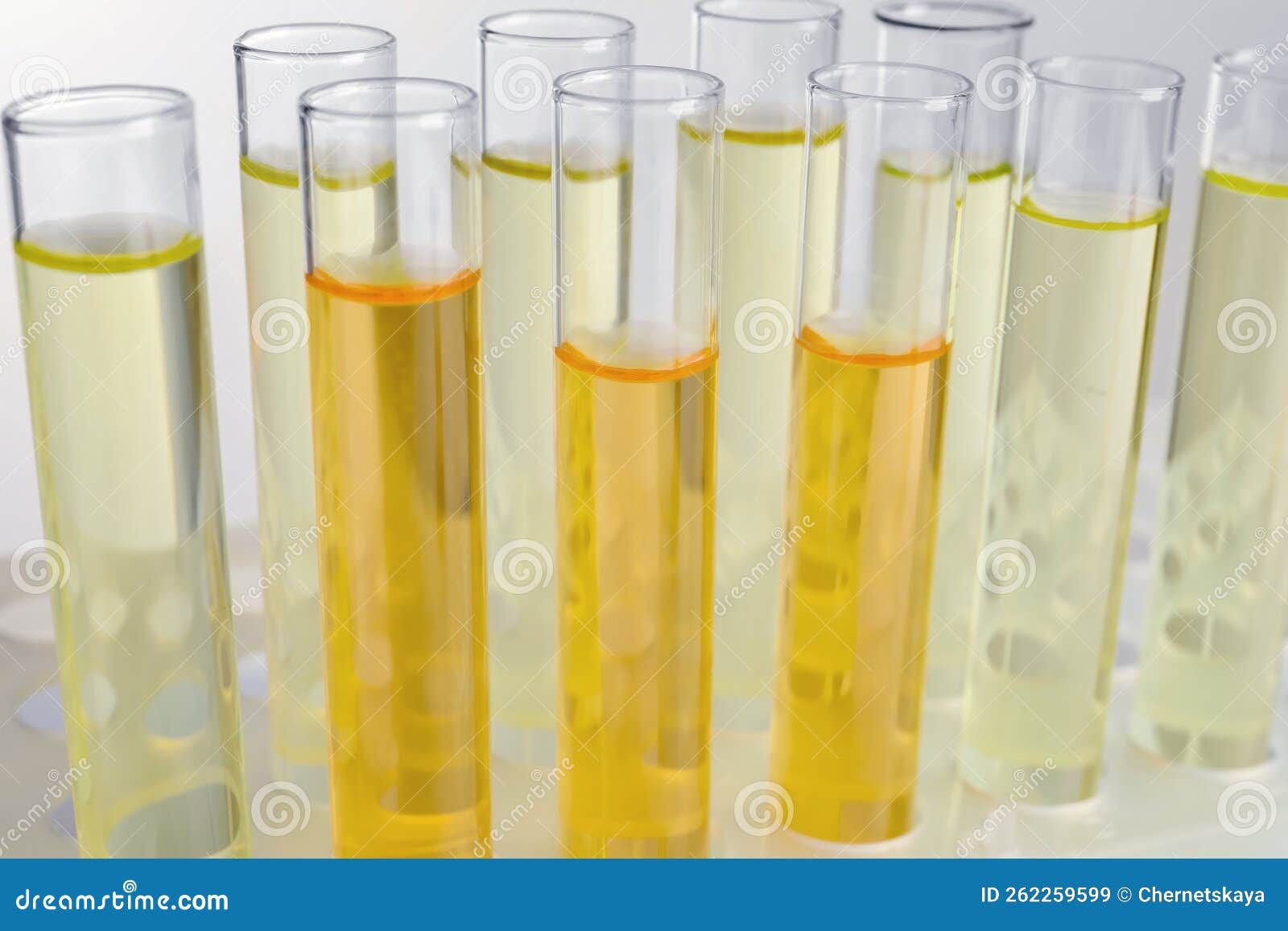 Tubes with Urine Samples for Analysis on Light Grey Background, Closeup ...