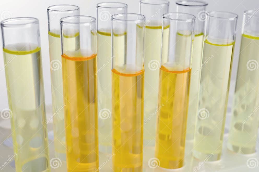 Tubes with Urine Samples for Analysis on Light Grey Background, Closeup ...