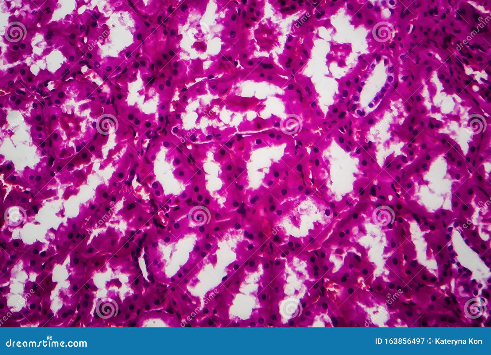 Tubular Atrophy, Light Micrograph Stock Image - Image of closeup, cell ...