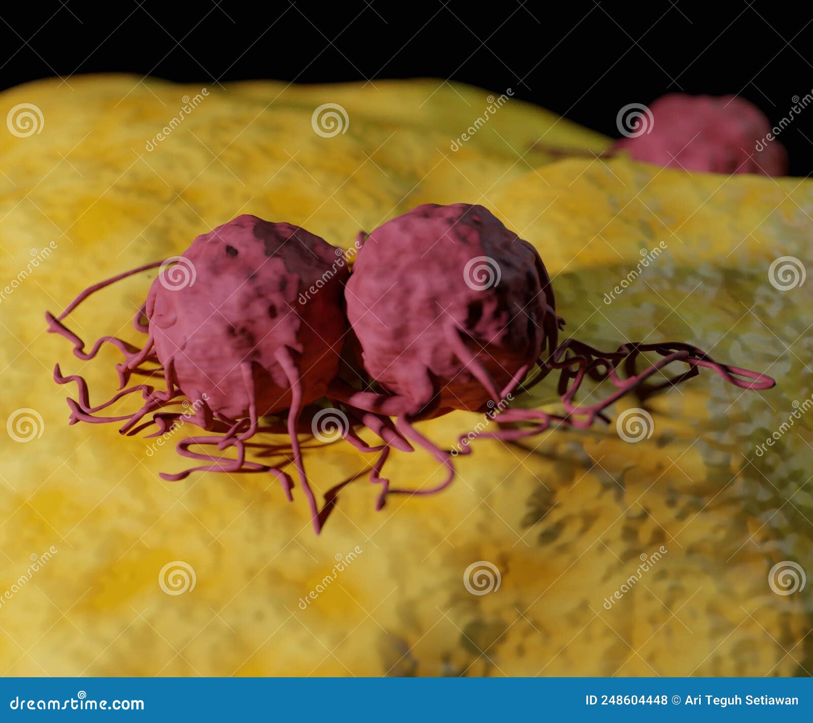 A Tumor Is Uncontrolled Growth Occurs In Solid Tissue As A Cancer Cell ...