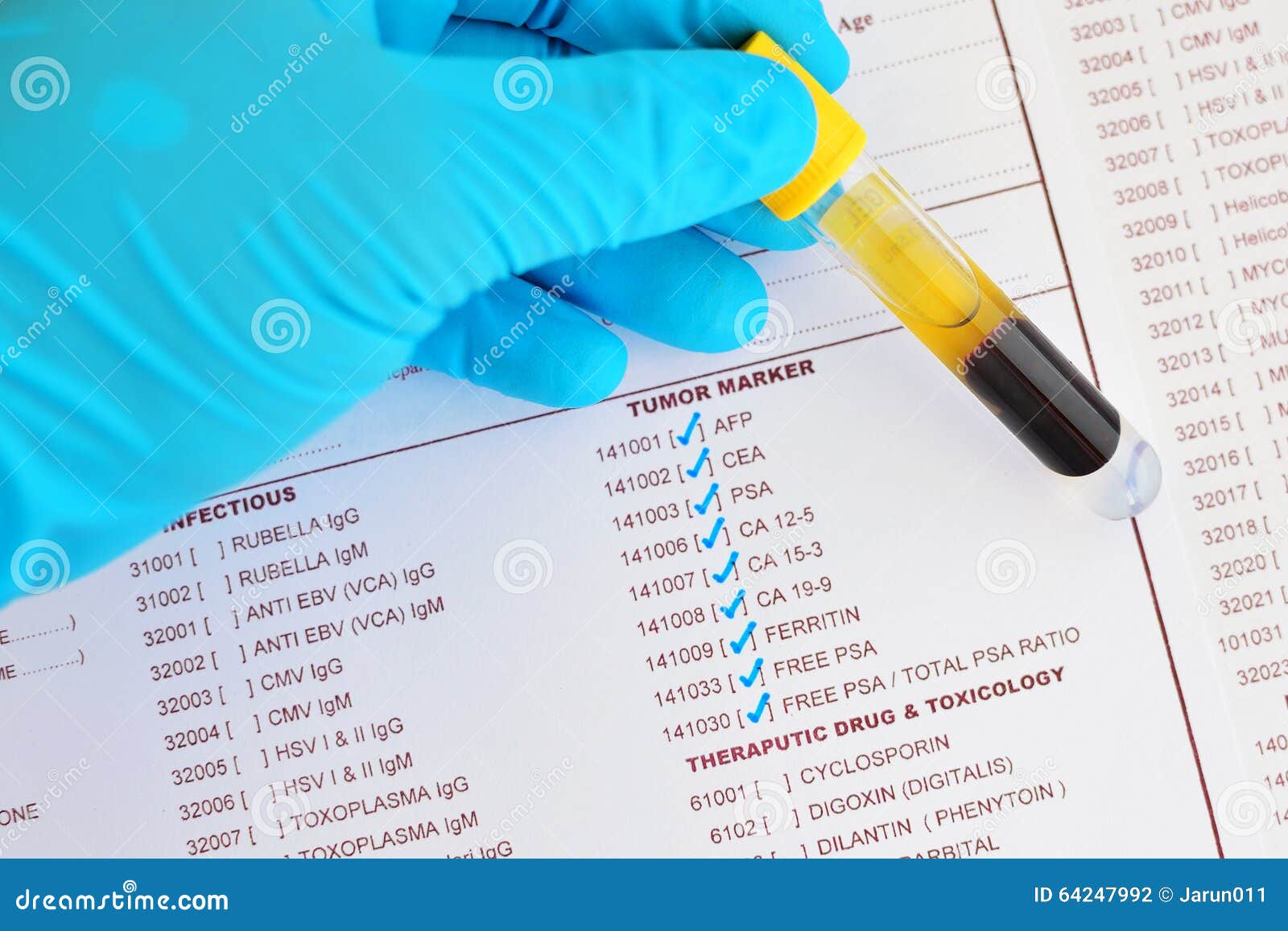 Tumor marker test stock photo. Image of analyzing, health - 64247992