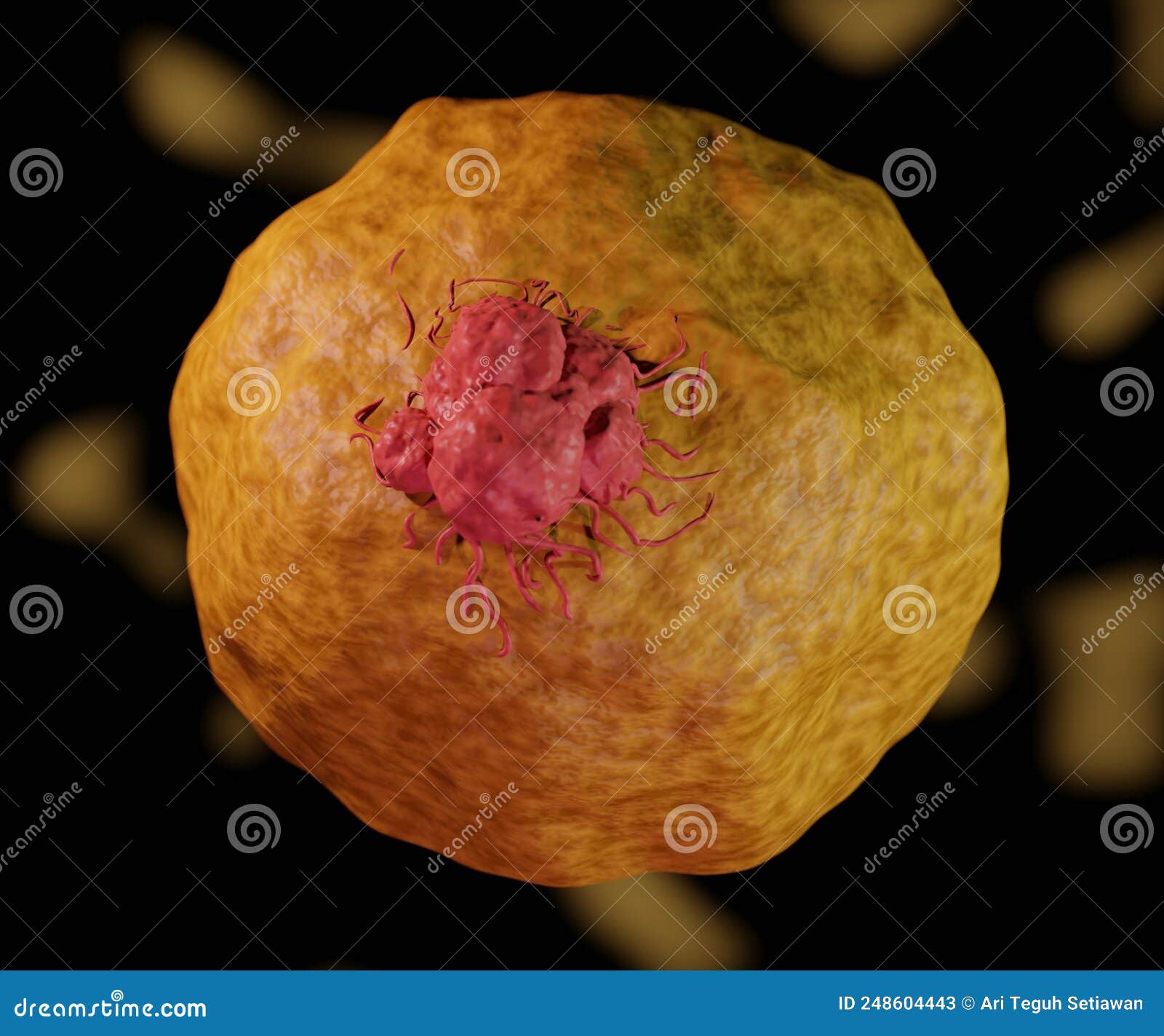 A Tumor is Uncontrolled Growth Occurs in Solid Tissue As a Cancer Cell ...