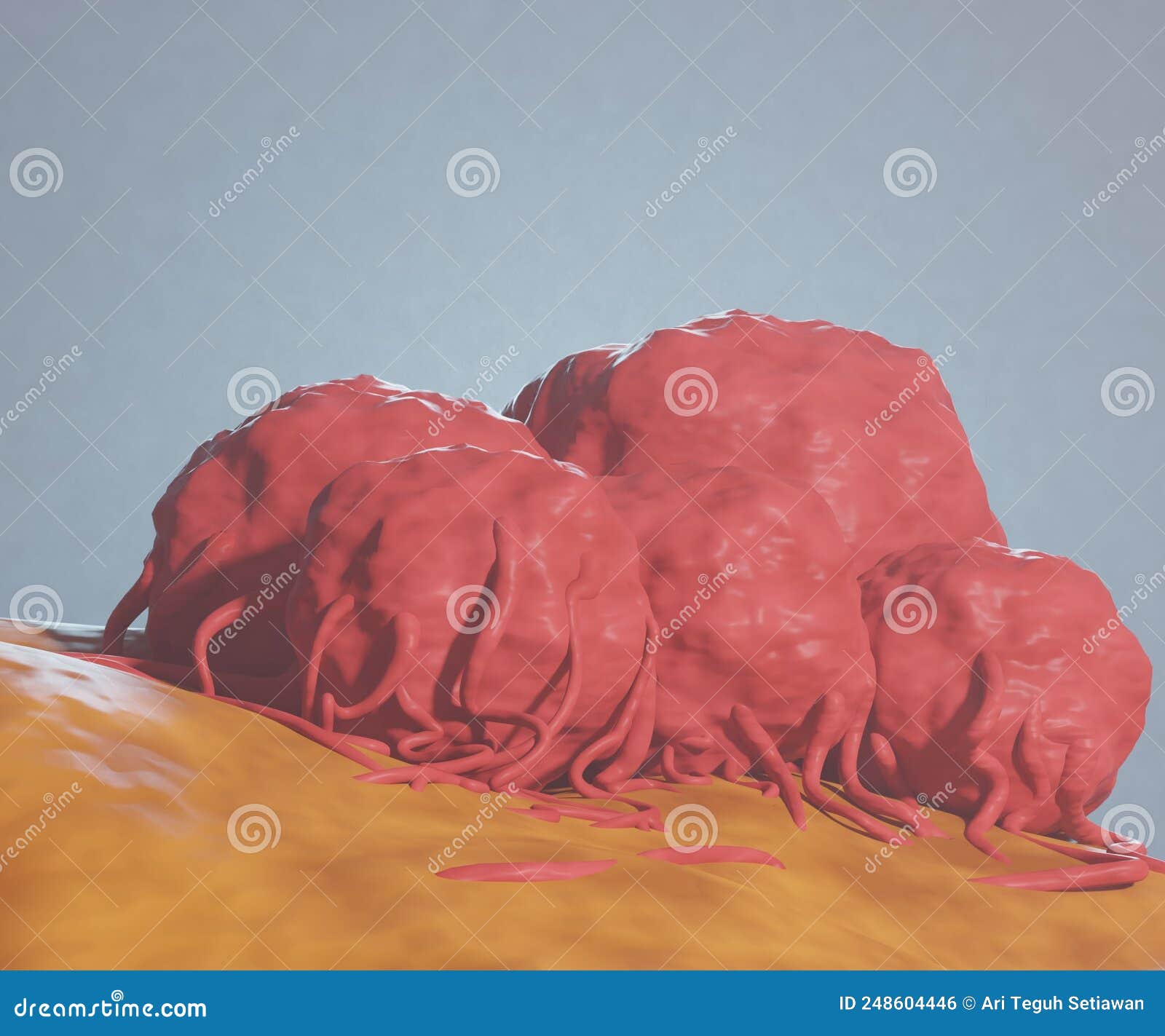 A Tumor Is Uncontrolled Growth Occurs In Solid Tissue As A Cancer Cell ...