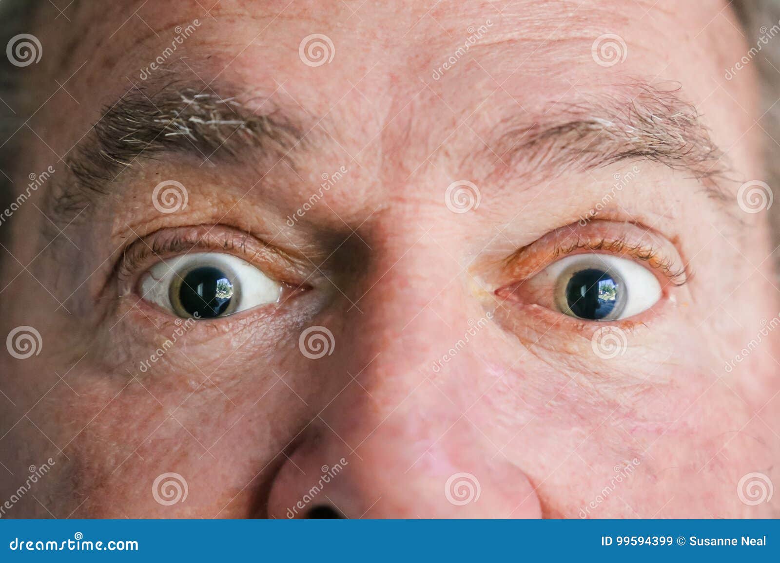 Twee uitgezette ogen stock afbeelding. Image of verzekerden - 99594399