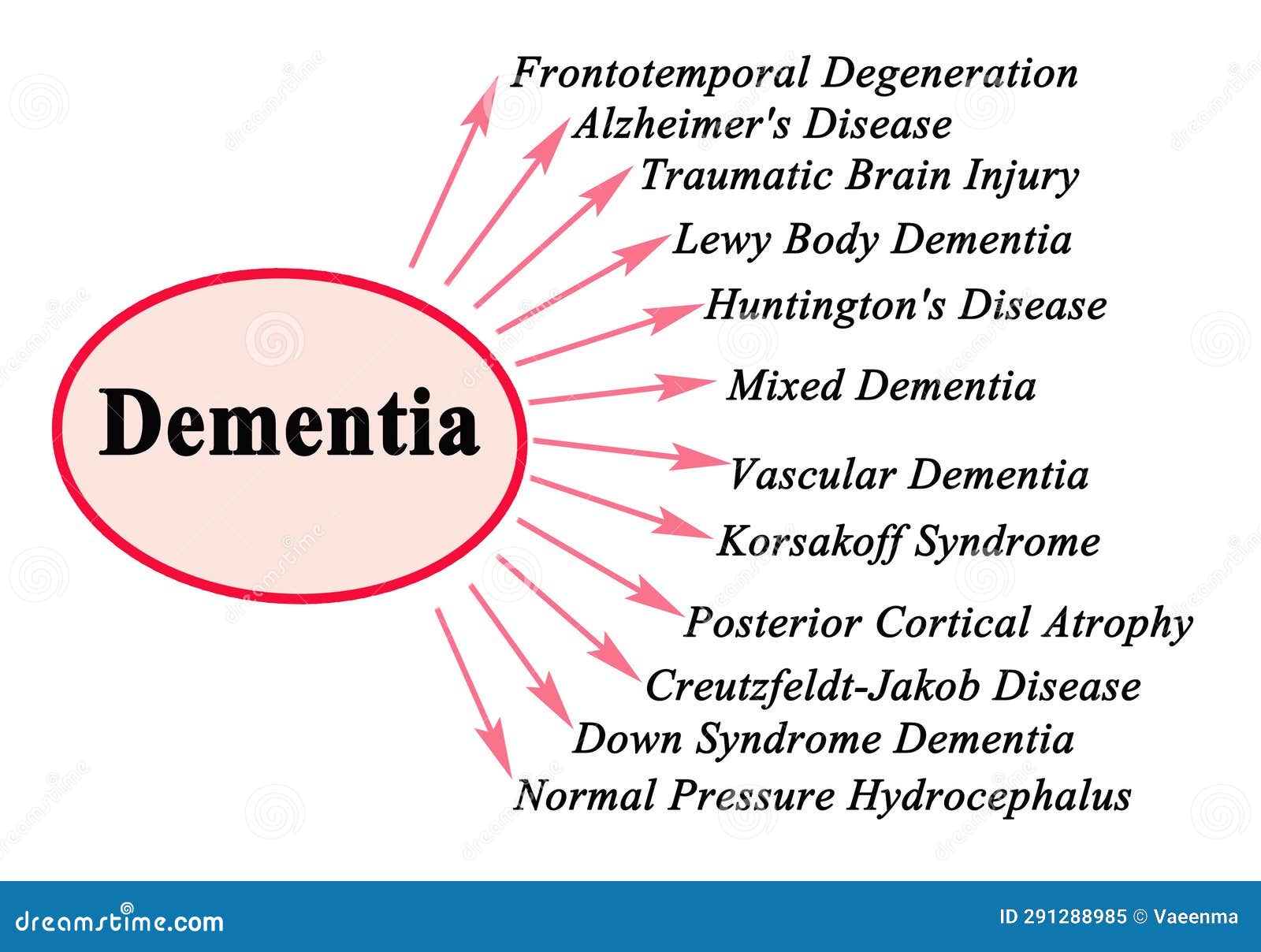 Twelve types of Dementia stock image. Image of lewy - 291288985