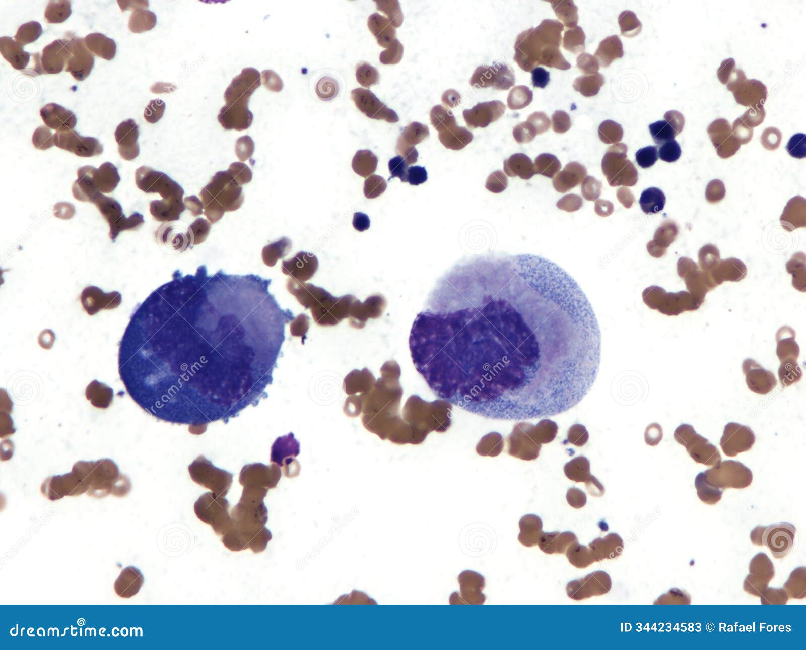 Megakaryocyte Is A Large Bone Marrow Cell That Produces Blood Platelets ...