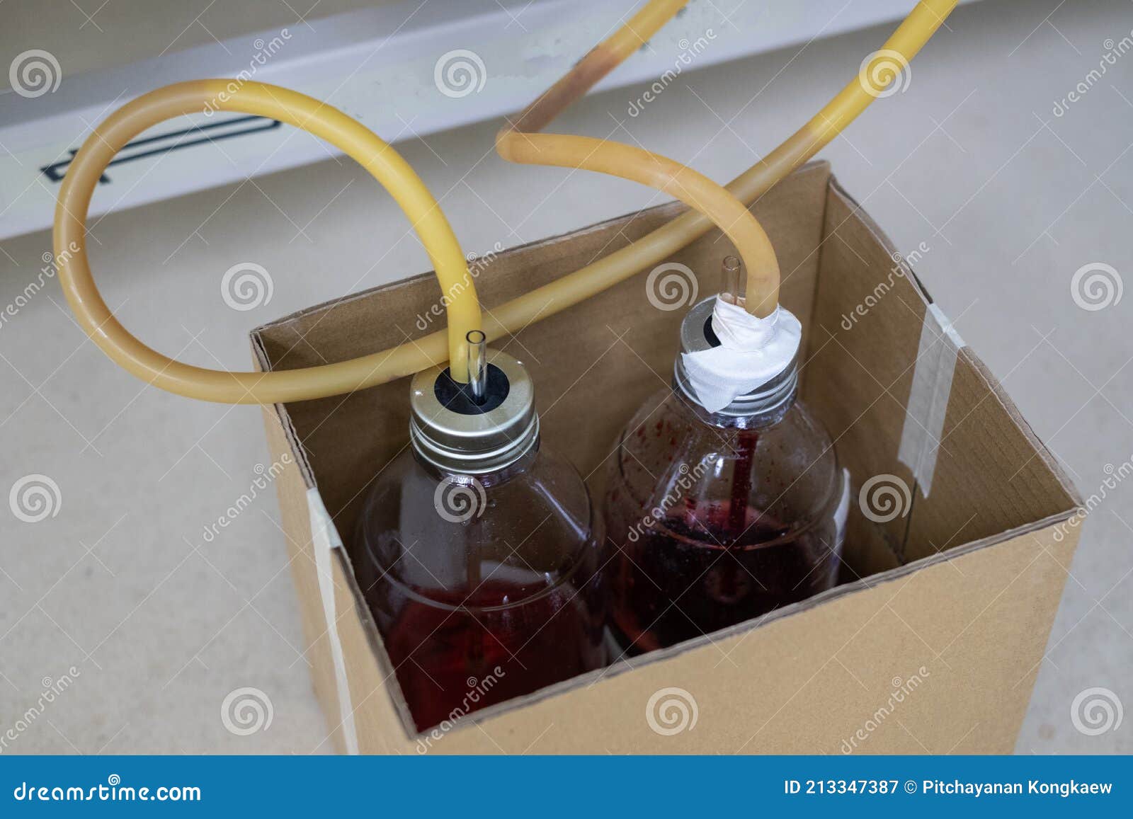 Two Bottle System of Chest Drainage for Patient Post Open Heart Surgery ...