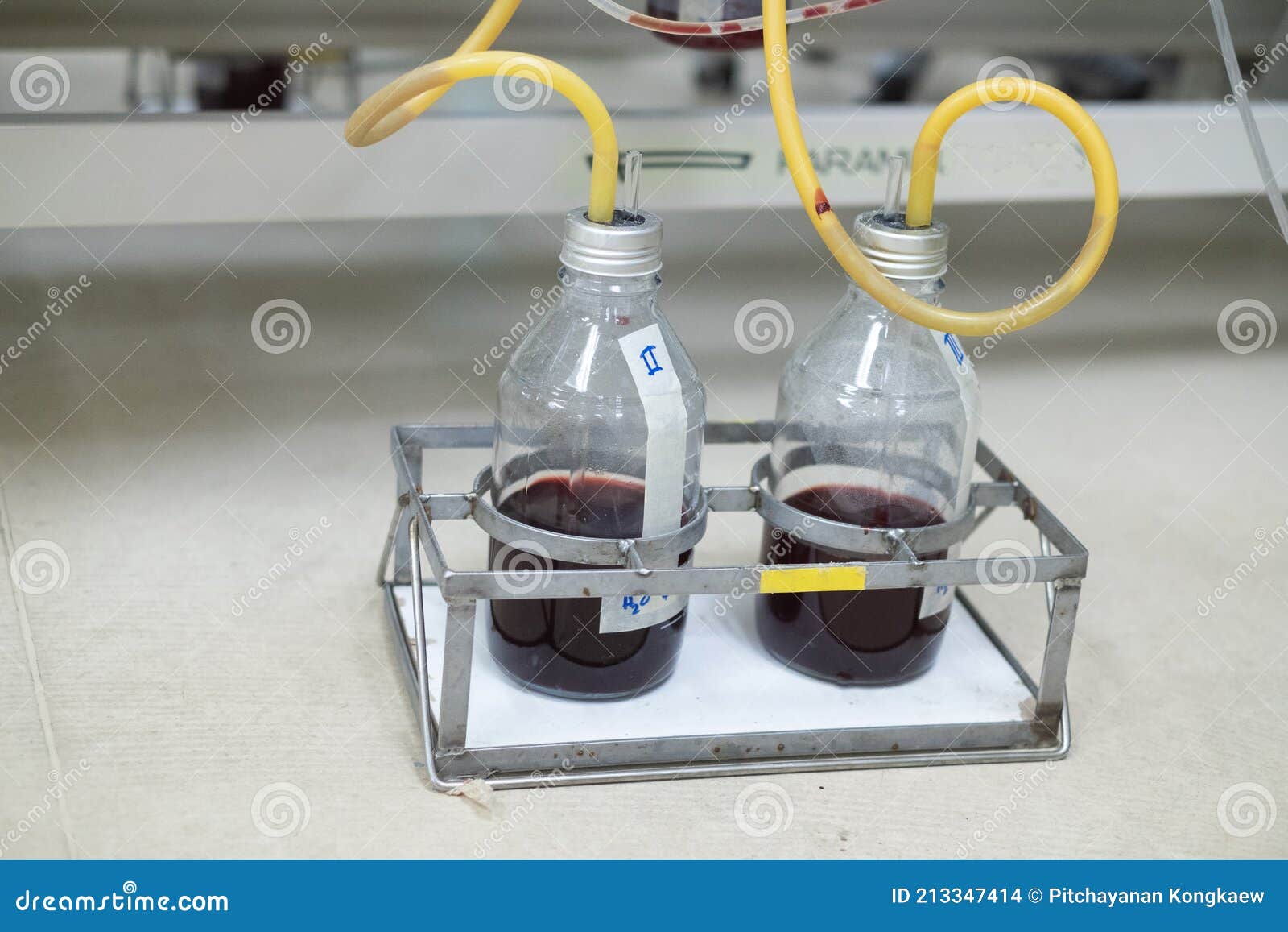 Two Bottle System of Chest Drainage for Patient Post Open Heart Surgery ...