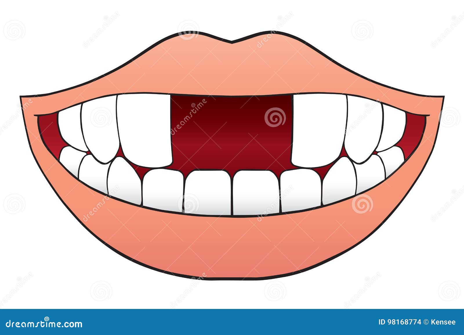 I Need Two Front Teeth