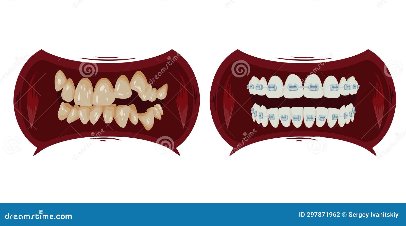 Two Images of Teeth, Curves on the Left and Yellow, Right Smooth and ...
