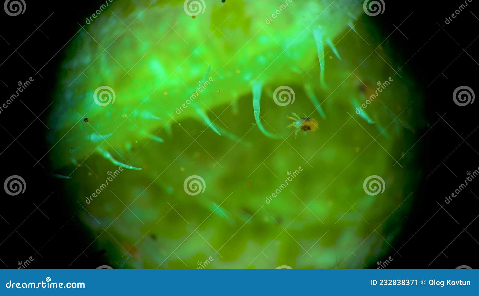 Two-spotted Spider Mite Under a Microscope, Tetranychus Urticae ...