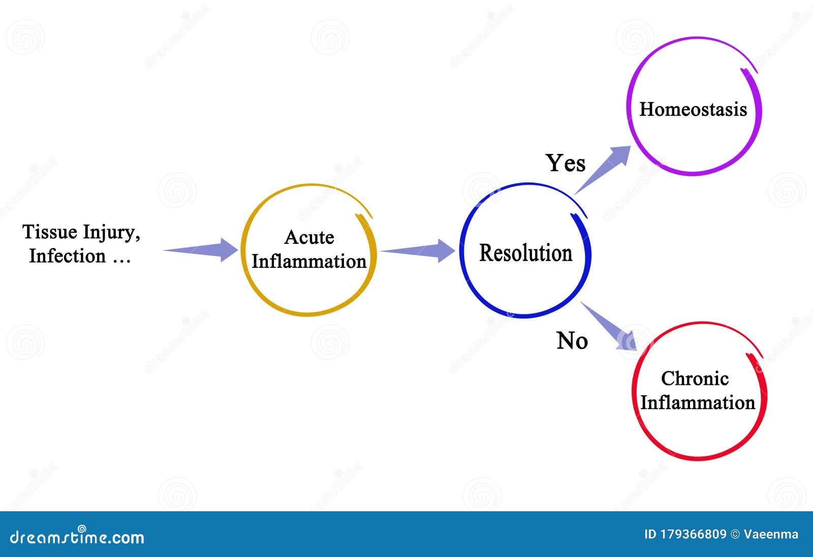 Ways of Resolution of Acute Inflammation Stock Illustration ...