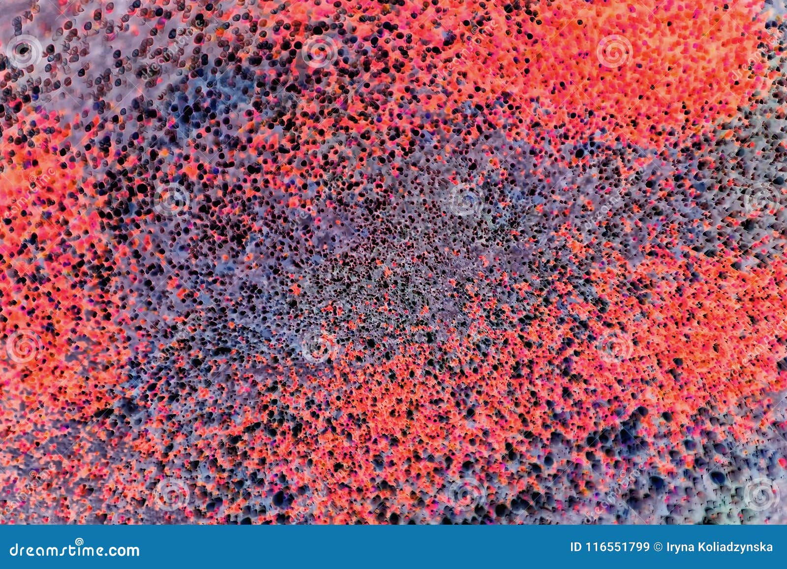 Type of Bacteria Under a Microscope, Bacteria and Microorganism Stock ...