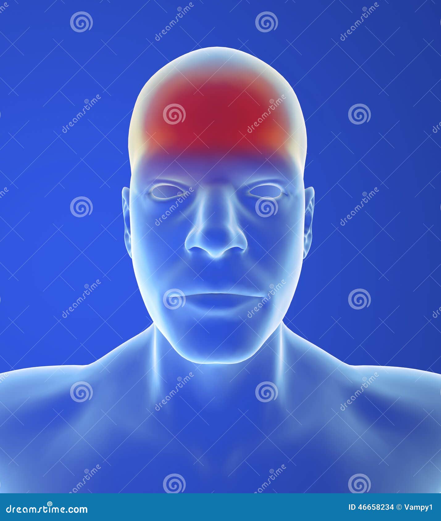 Man With Photophobia. Migraine And Light Sensitivity Vector ...
