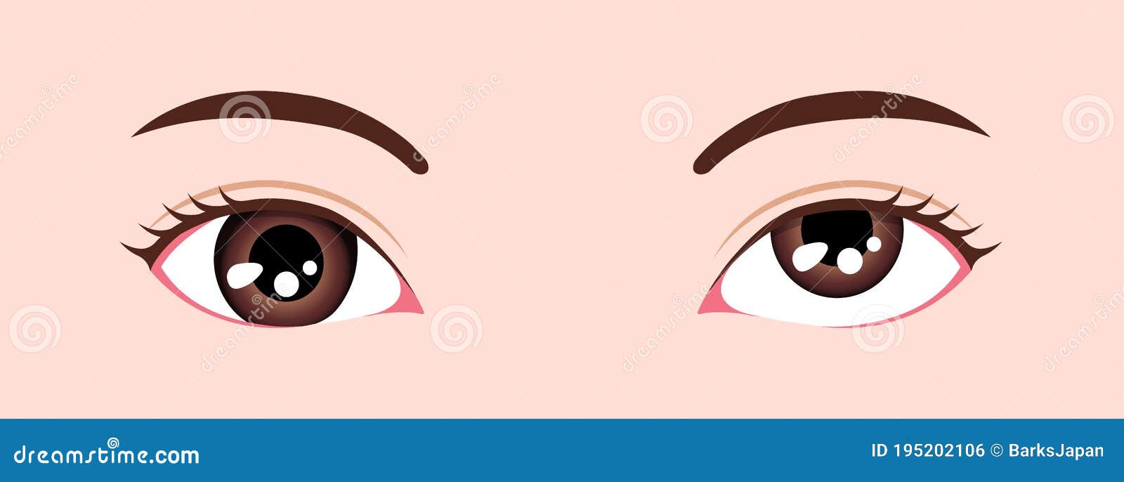 Type of Strabismus Vector Illustration / Hypertropia Stock Vector ...
