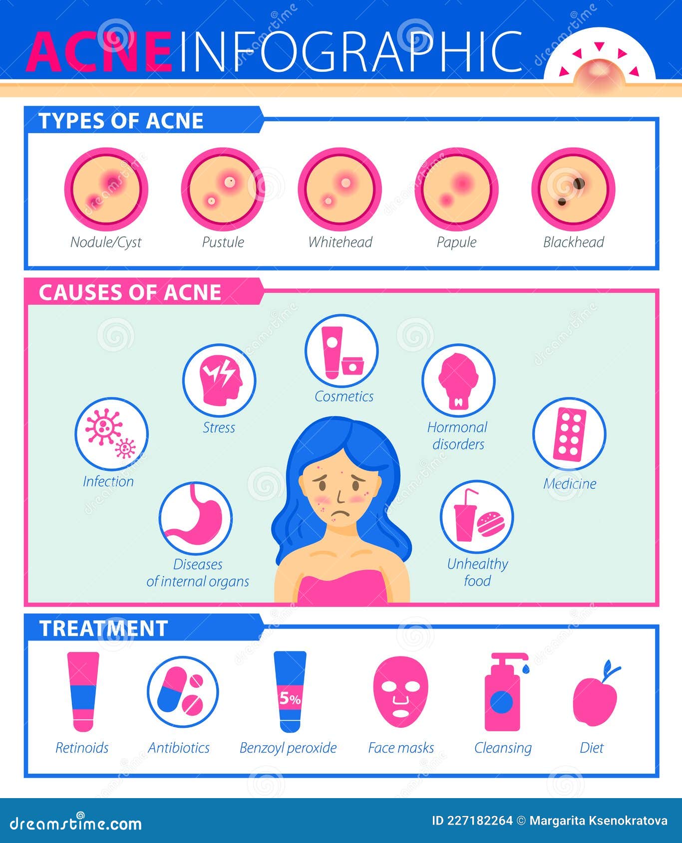 Types of Acne, Causes of the Disease, Treatment. Infographics of Acne ...