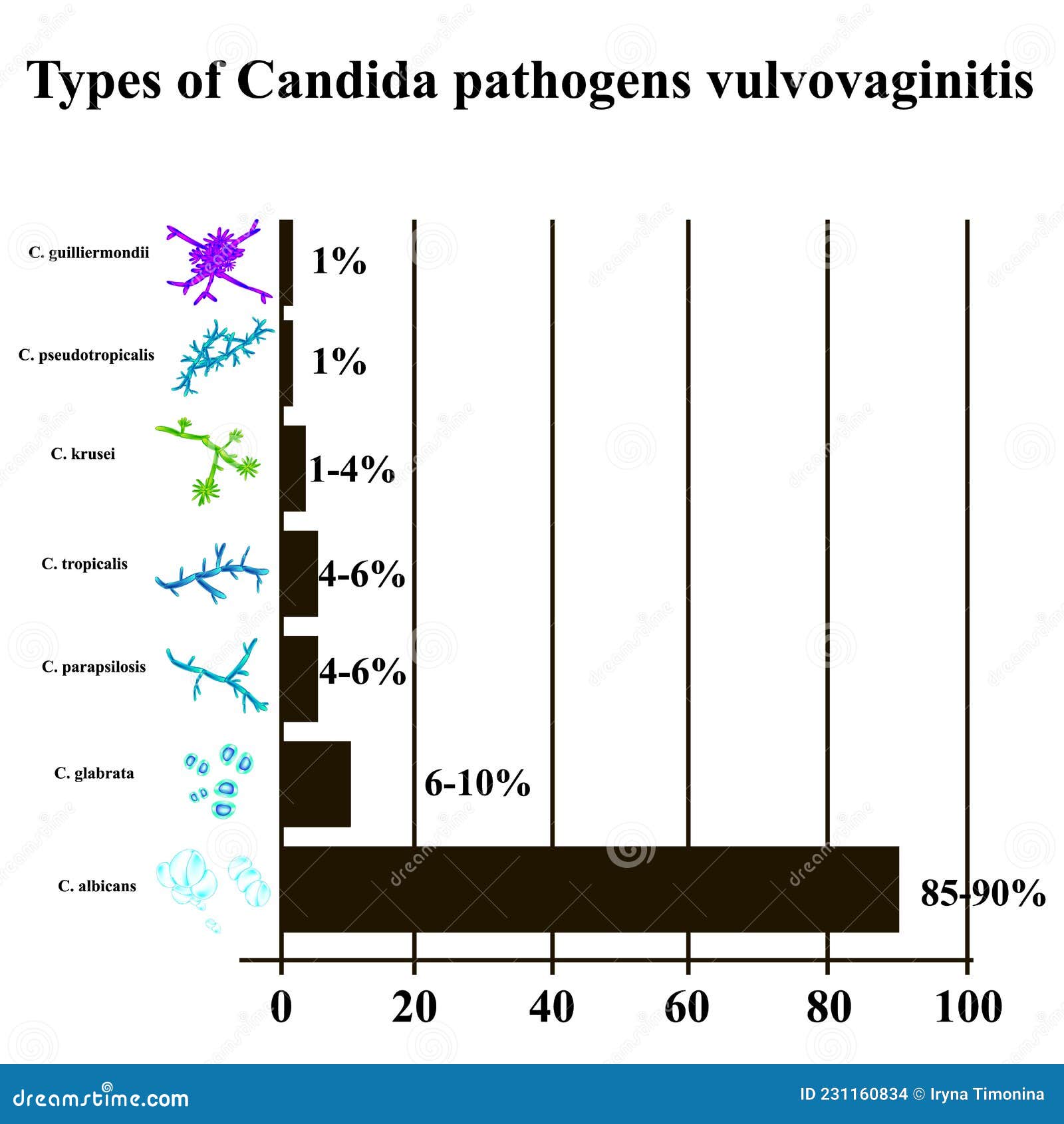 Candida Vulvovaginitis