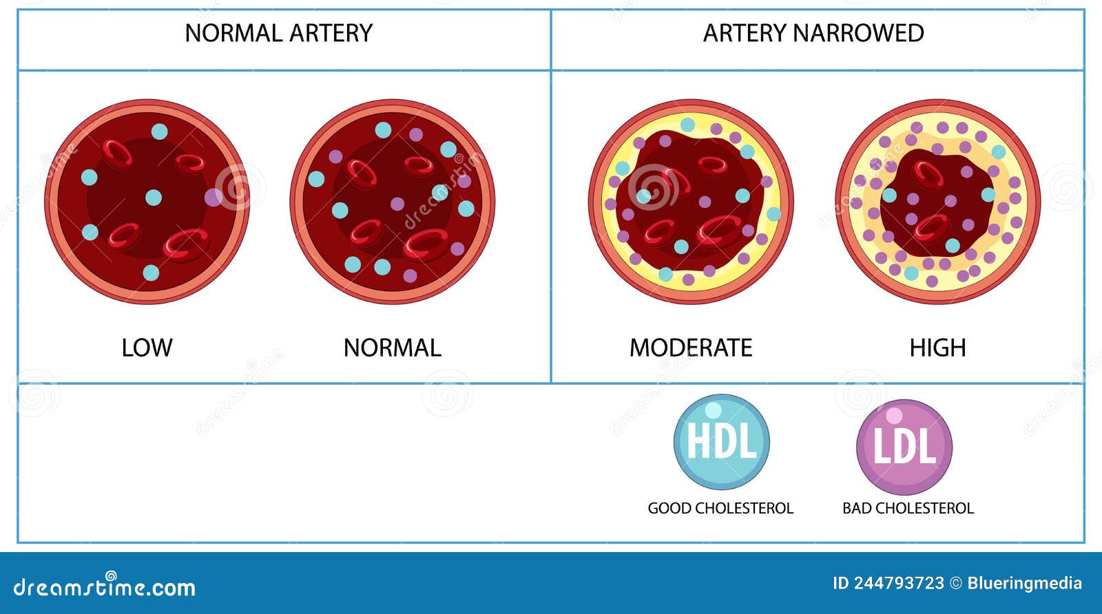 Types Of Cholesterol Comparison With Hdl And Ldl Cartoon Vector