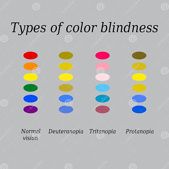 Types of Color Blindness. Eye Color Perception Stock Vector ...