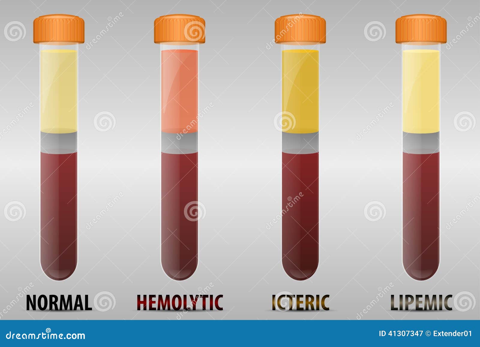 Types De Terrain Communal De Sérum Sanguin Illustration de Vecteur ...